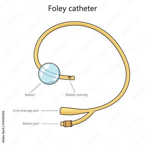 Urinary Foley Catheter Structure Diagram Hand Drawn Schematic Raster