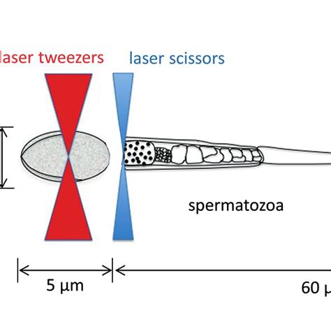 2 Laser Assisted In Vitro Fertilization Bad Quality Sperm Of Low Download Scientific
