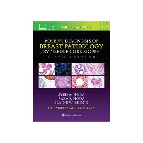 Rosen`s Diagnosis Of Breast Pathology By Needle Core Biopsy Nobel