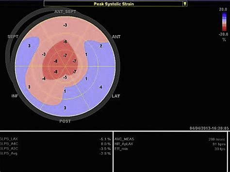 Strain Longitudinal Global De 3 Download Scientific Diagram
