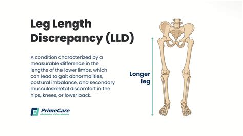 Uneven Leg Length After Knee Replacement