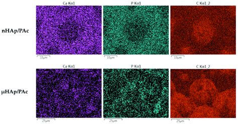 Examples Of Calcium Phosphorus And Carbon Distribution Maps In The