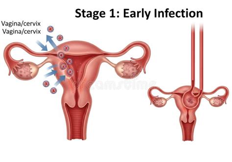 Diagram Illustrating The Early Stage Of Stock Illustration
