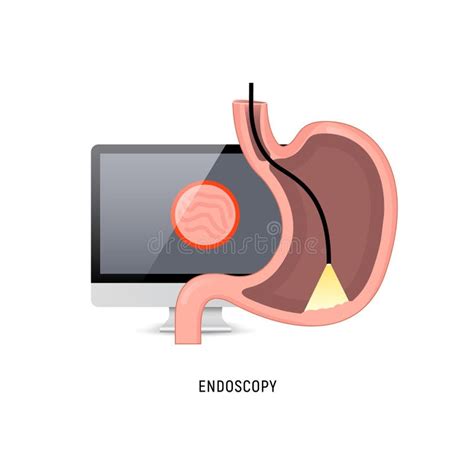 Cartoon Endoscopy Stock Illustrations 239 Cartoon Endoscopy Stock Illustrations Vectors