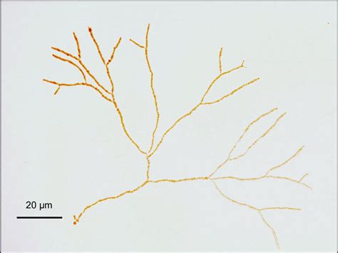 2 Microscopic Appearance Of A Trichoderma Single Spore Colony After 48 2 Microscopic Appearance Of A Trichoderma Single Spore Colony After 48