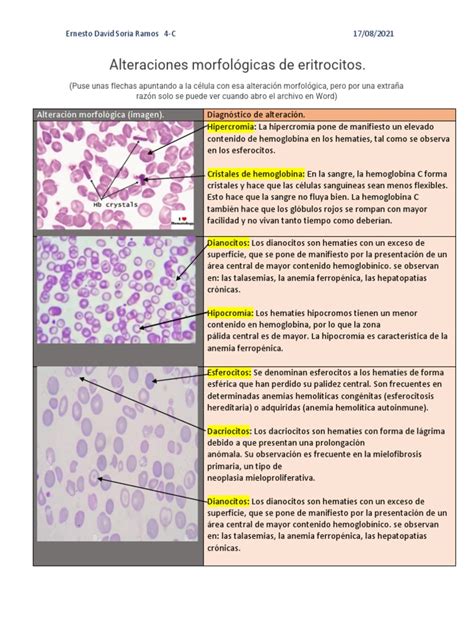 Alteraciones Morfológicas De Eritrocitos By Expresso Pdf Glóbulo