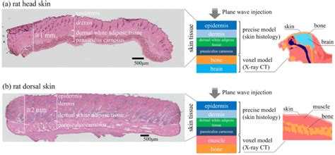 参数变化对基于真实大鼠精确皮肤厚度的毫米波剂量测定的影响 Scientific Reports X Mol