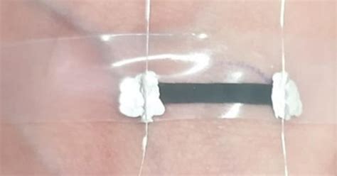 Researchers Developed Graphene Based Sensing Technology For Medical Devices Assignment Point