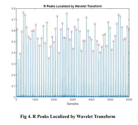 Github Prar2902 Ecg Spo2 Osa Detecting Obstructive Sleep Apnea Using Ecg And Spo2 Signals With