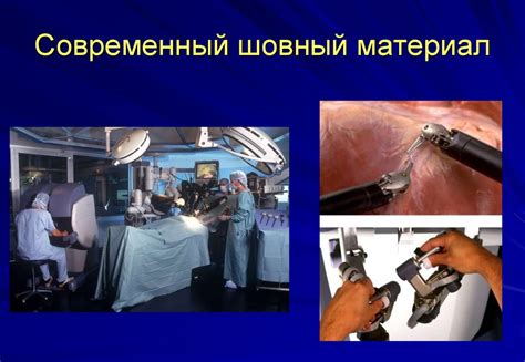 Современный шовный материал - презентация онлайн