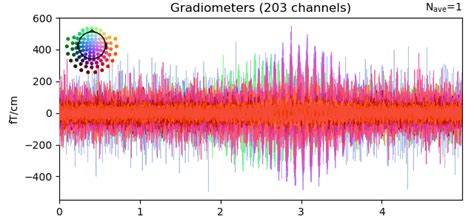 Compute Sesame Inverse Solution On Simulated Data In The Frequency Domain — Sesameeg 003