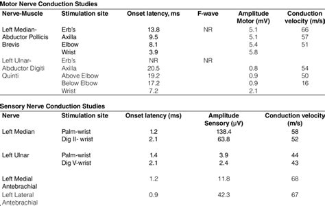 Neurophysiological Findings Download Table