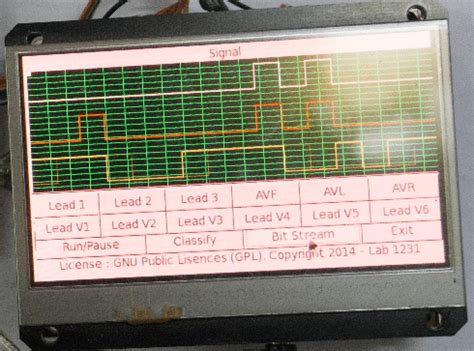 The Bit Stream User Interface There Are Three Bit Streams Of The Three Download Scientific