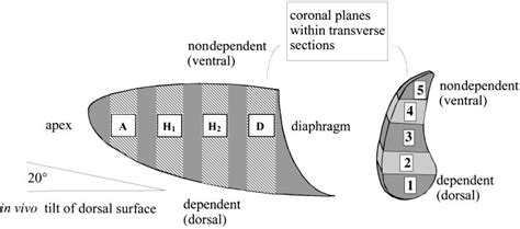 lung sectioning scheme before reconstruction transverse sections are
