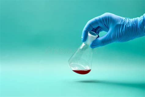 Unrecognizable Scientist Holding Titration Flask In Laboratory Stock Image Image Of Diagnosis