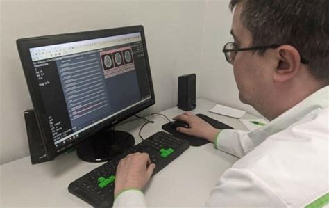 В Україні почали використовувати штучний інтелект у медицині