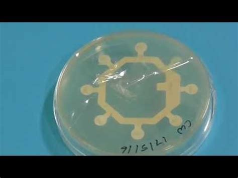 Aseptic Techniques Practical YouTube