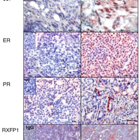 Porcine Relaxin Influences Histological Tumour Characteristics A