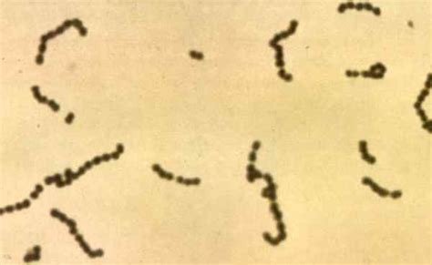 Différence entre Enterococcus et Streptococcus Prodiffs