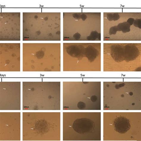 Development Of Spheroids In The Microfluidic Chips And Well Plates