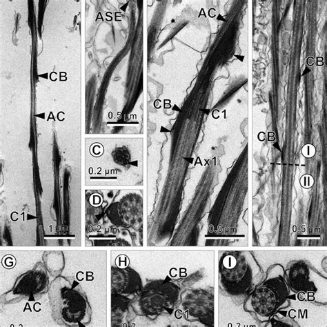 Schematic Drawing Showing The Main Stages Of Spermiogenesis Of