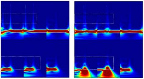 Fault Diagnosis Techniques For Electrical Distribution Network Based On Artificial Intelligence