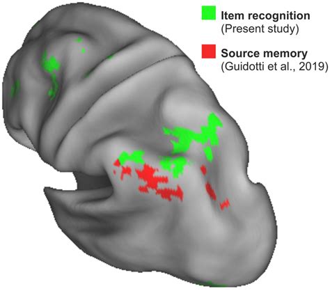 Choice Predictive Activity In Item Recognition And Source Memory The
