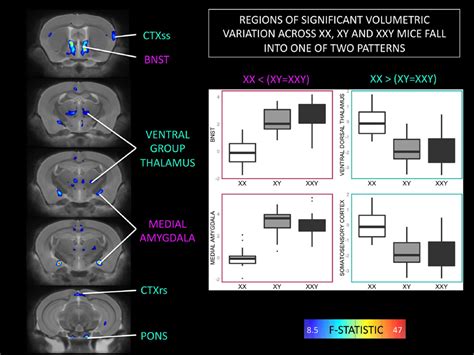 Triangulating The Sexually Dimorphic Brain Through High Resolution Neuroimaging Of Murine Sex
