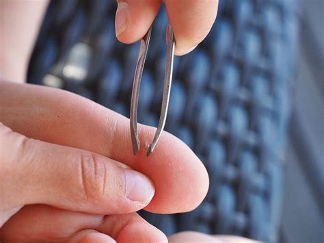 How To Remove A Splinter First Aid And Tips How To Remove A Splinter First Aid And Tips