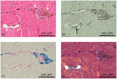 Typical Examples Of Synovium Histology Of The Implant Group A