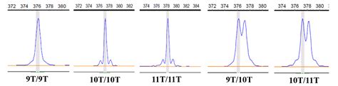 A Poly Da Dt Tract In The Igf1 Gene Is A Genetic Marker For Growth