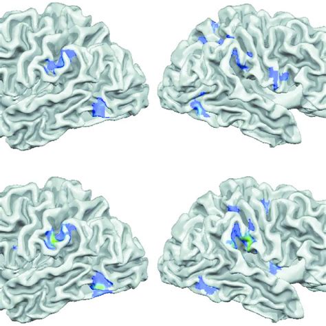 Parametric Activations Shows Brain Regions Showing Associations With
