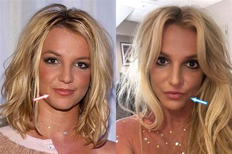 Did Britney Spears Have Cosmetic Surgery Before And After 2018