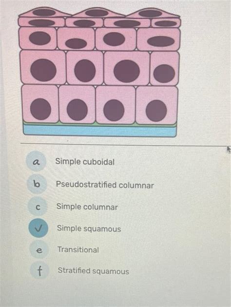Solved 000 Simple Cuboidal B Pseudostratified Columnar С