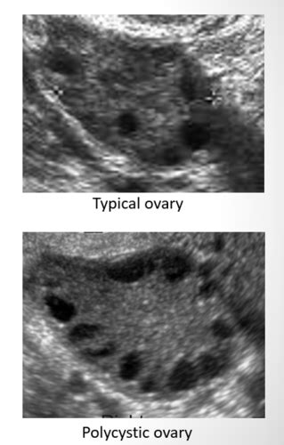 Exam Repro Flashcards Quizlet