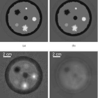 PDF Breast Ultrasound Computed Tomography Using Waveform Inversion With Source Encoding