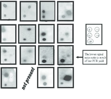 Assay Specificity And Sensitivity Autoradio Graphy Results Of Hpv