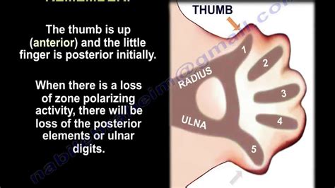Apical Ectodermal Ridge Zone Polarizing Activity Everything You Need To Know Dr Nabil