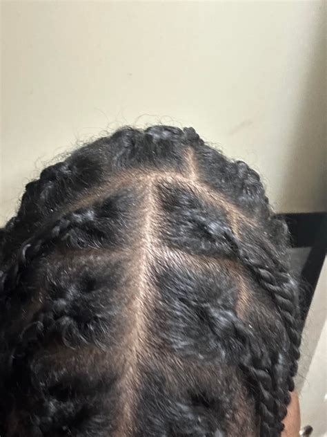 Are These Going To Turn Into Think Or Thin Dreads R Dreadlocks