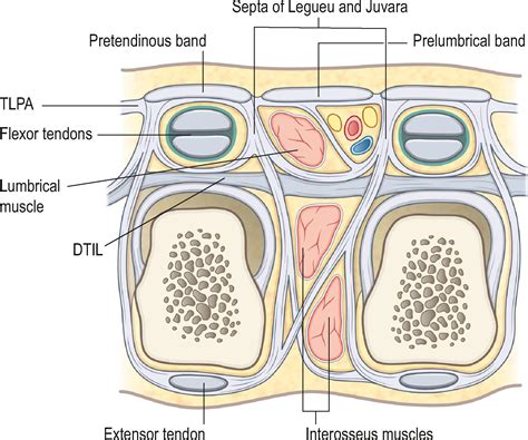 Dupuytrens Disease Clinical Tree