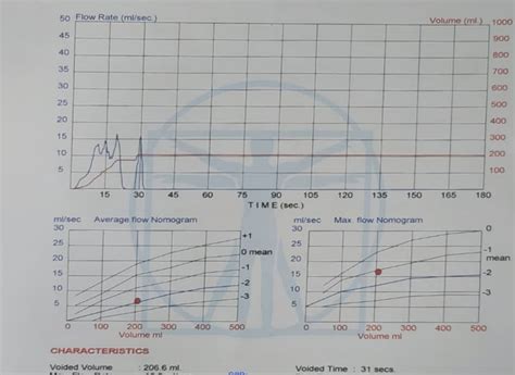 Health And Treatment Uroflowmetry Interpretation
