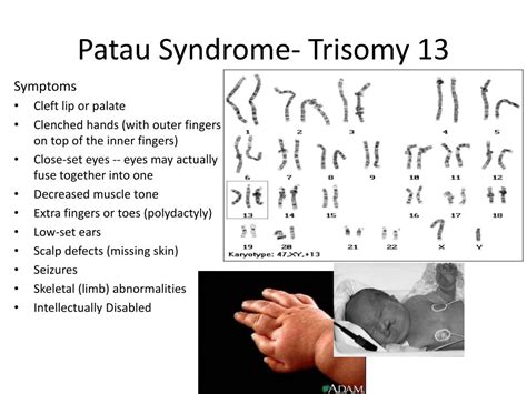 Ppt Karyotype And Chromosomal Mutation Notes Powerpoint Presentation