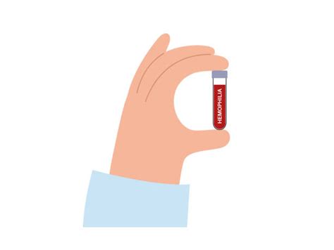 70 Fibrinogen Ilustrasi Grafik Vektor And Clip Art Bebas Royalti Terbaik Istock