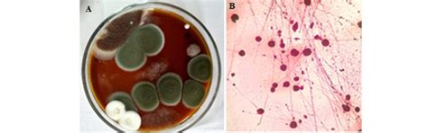 A Isolation Of Aspergillus Sp From Sediment Sample On Pda Plateand Download Scientific