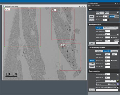 Sbf Sem Imaging Parameters Used For 3view Data Collection With Gatan