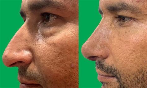 Learn About Cosmetic Surgery Claims Haris Malik Posted On The Topic Linkedin