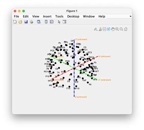 Creating A Bem Volume Conduction Model Of The Head For Source Reconstruction Of Eeg Data
