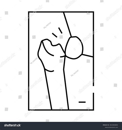 Hip Mri Color Over 25 Royalty Free Licensable Stock Illustrations