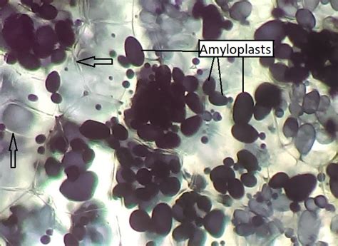 Potato Cell Amyloplast