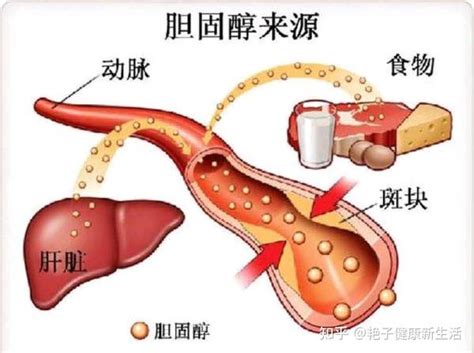 不想胆固醇高，要少吃反式脂肪酸，如何判断食物含有反式脂肪酸？ 知乎